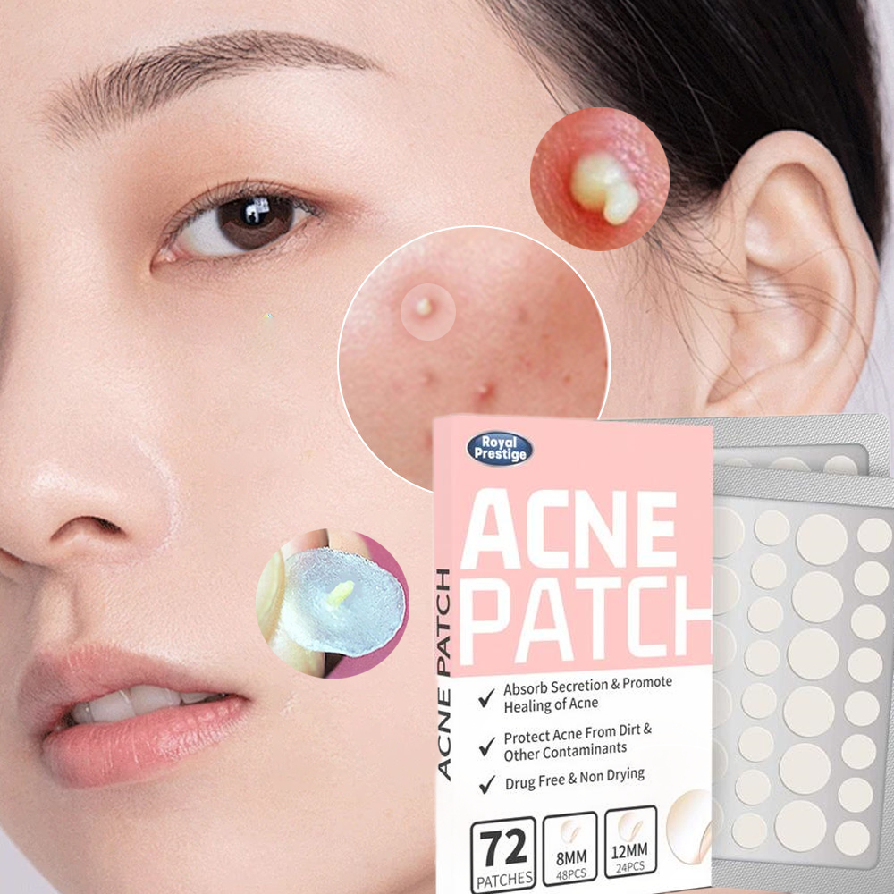 Acne Patch Tampalan Jerawat Acne Care Patch Acne Removal Pimple Patch ...