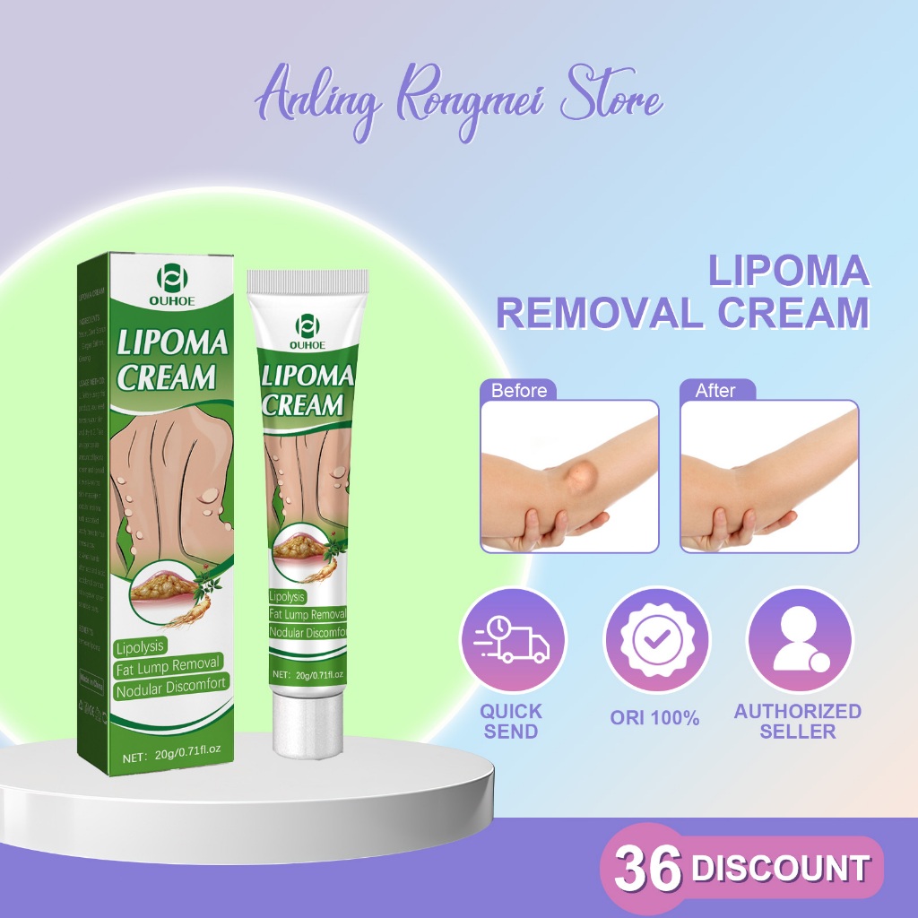 OUHOE Lipoma Removal Cream 20g Subcutaneous Lump Treatment Skin ...