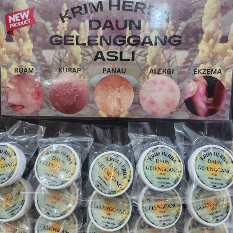 Ubat Gatal Herba Daun Gelenggang 20g Ubat Gatal Bisul Kudis Kurap ...