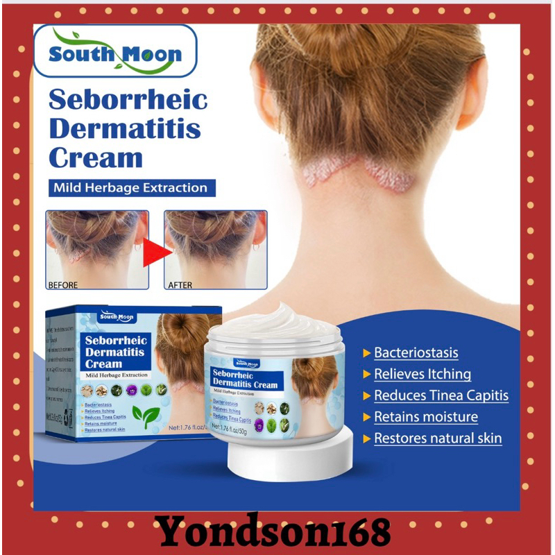 South Moon Seborrheic Dermatitis Cream Antibacterial Cream Anti ...