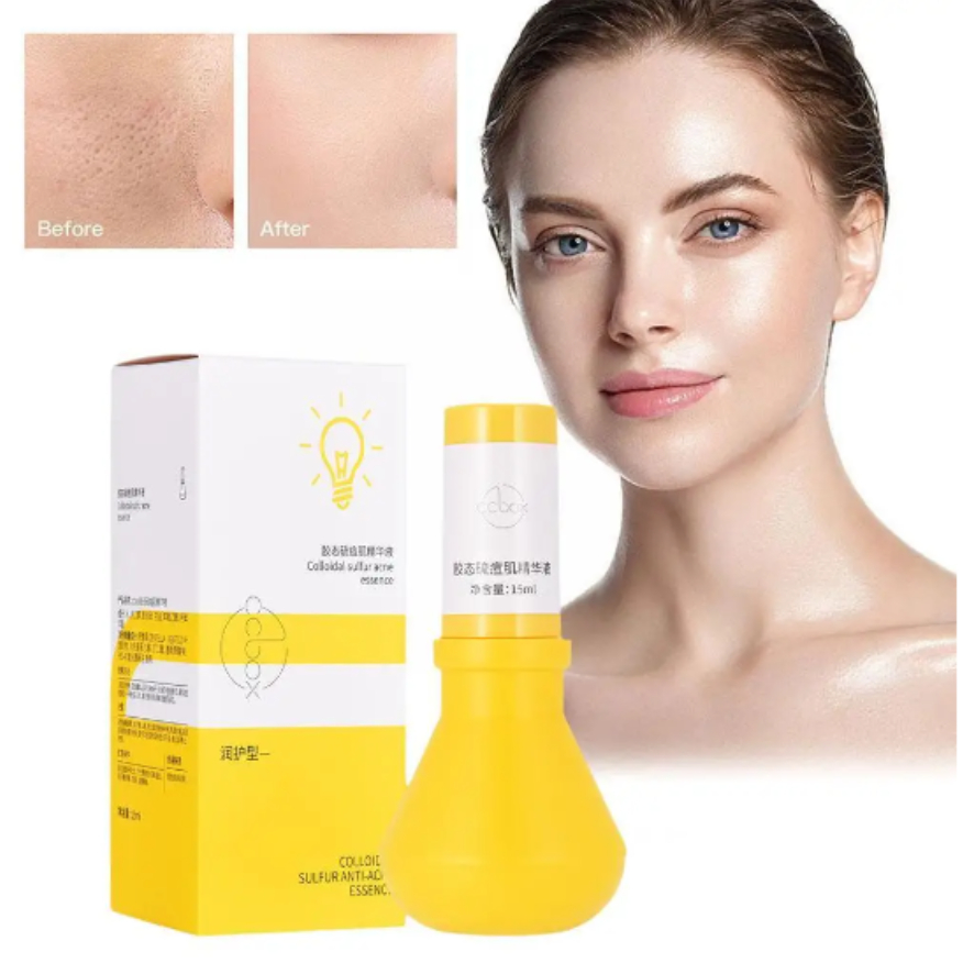 Colloidal Sulfur Acne Serum 15ml Strawer Spot Treatment White Heads ...