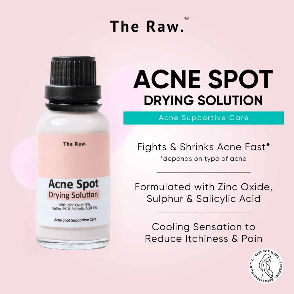 The Raw. Acne Spot Drying Solution | Shopee Malaysia
