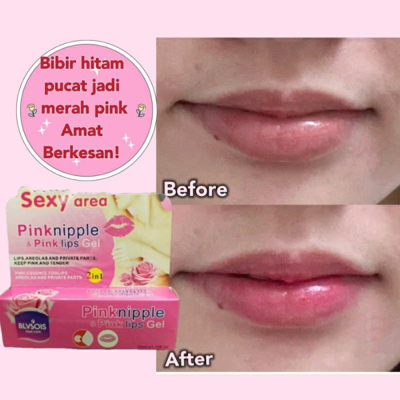 Dark Lip & Nipple turn Pinky cream/ Krim Bibir Tetek Hitam jadi Merah ...
