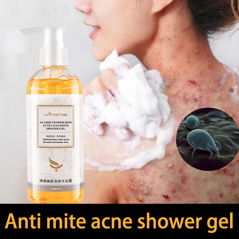 Removal Mites Body Wash 除螨沐浴露 Back Acne-Removing Mites Shower Gel 260ml ...