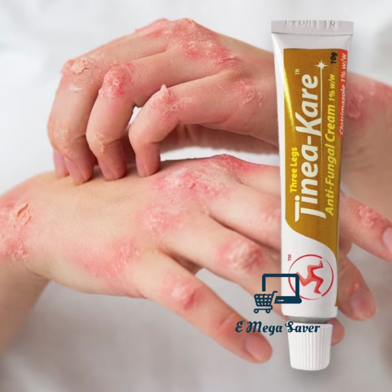 Three Legs Tinea-Kare Anti-Fungal Cream 10g (0.35oz) | Shopee Malaysia
