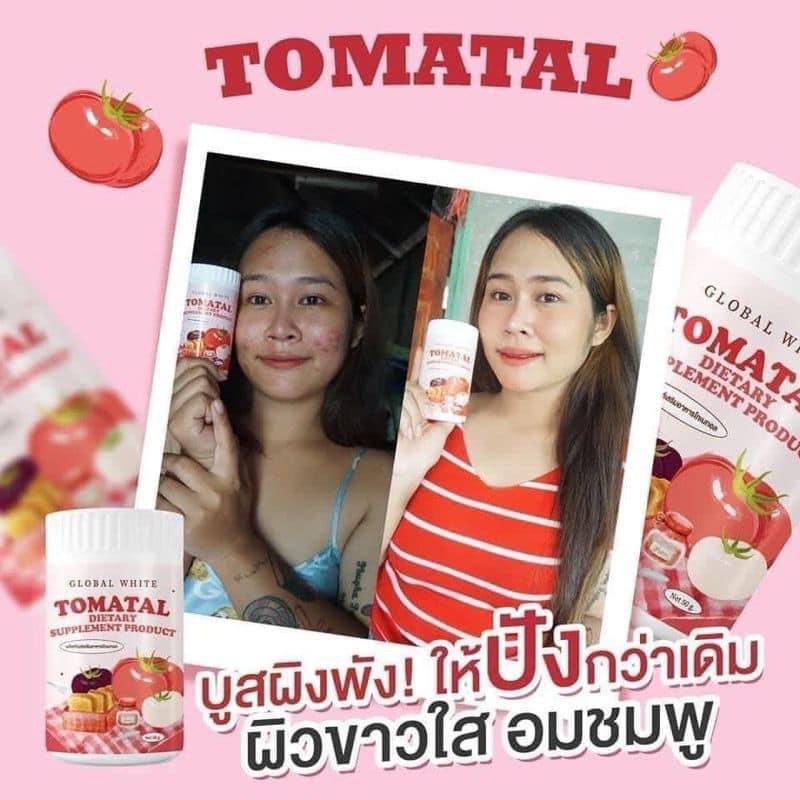 GLOBAL WHITE TOMATAL 🔥💯 | Shopee Malaysia