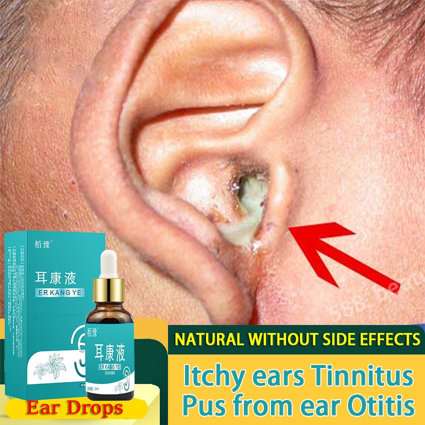 Otitis Ear Drops 中耳炎滴耳液 耳鳴 藥 Earwax Cleanser tinnitus ear drops Ear Wax ...