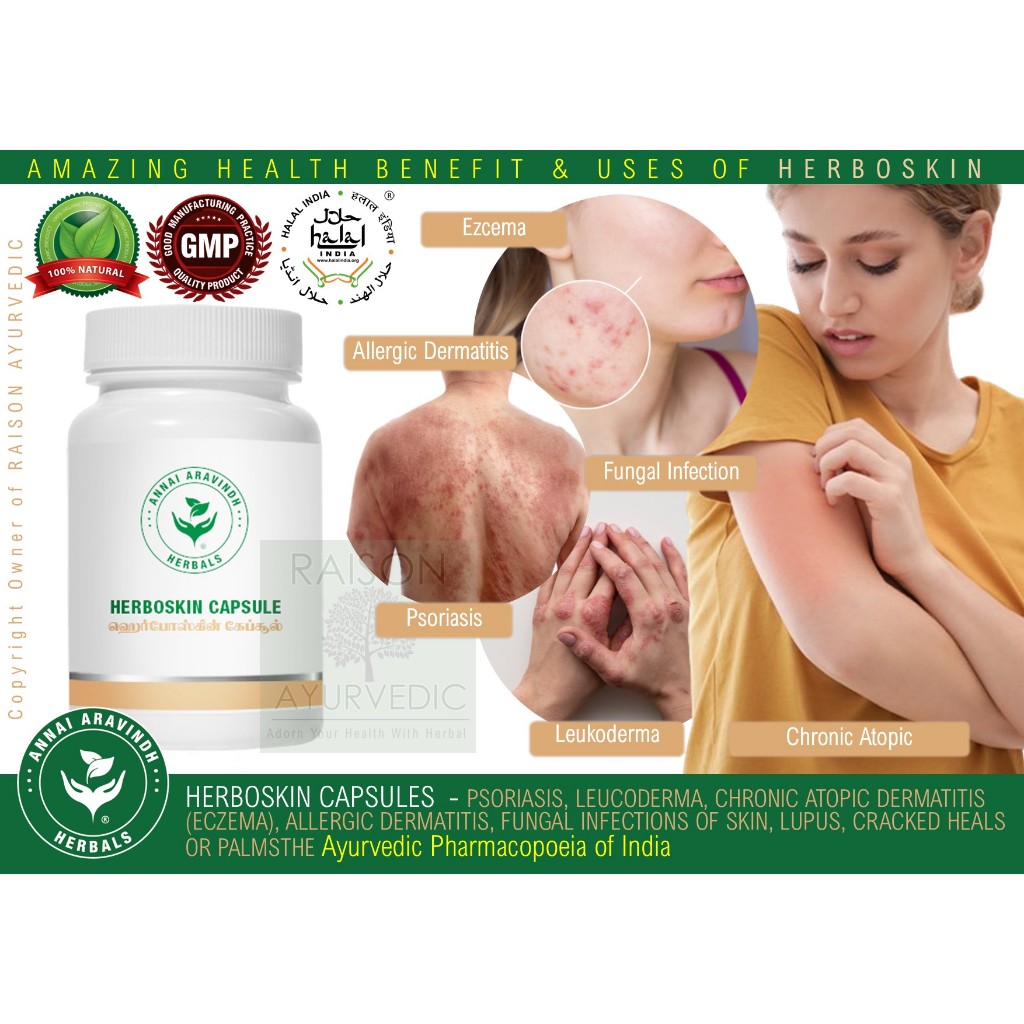 HERBOSKIN CAPSULES 90- PSORIASIS, LEUCODERMA, CHRONIC ATOPIC DERMATITIS ...