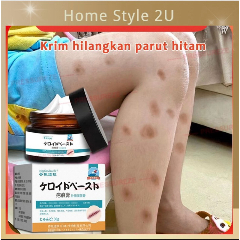 Japan Scar Removal Cream krim hilangkan parut hitam luka lama Hilangkan ...