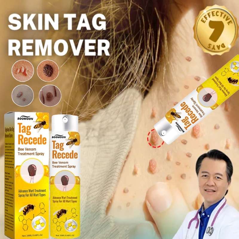Bee Venom Spray Tag Recede Wart Remover Skin tag remover Ubat ketuat ...