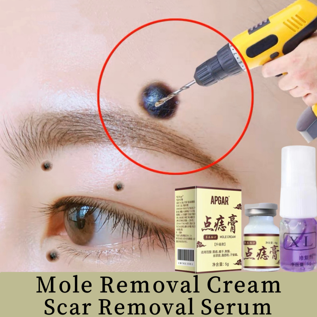 Krim Ubat Tahi Lalat Kutil Biji Kolestrol Ketuat Mole Removal Cream No ...