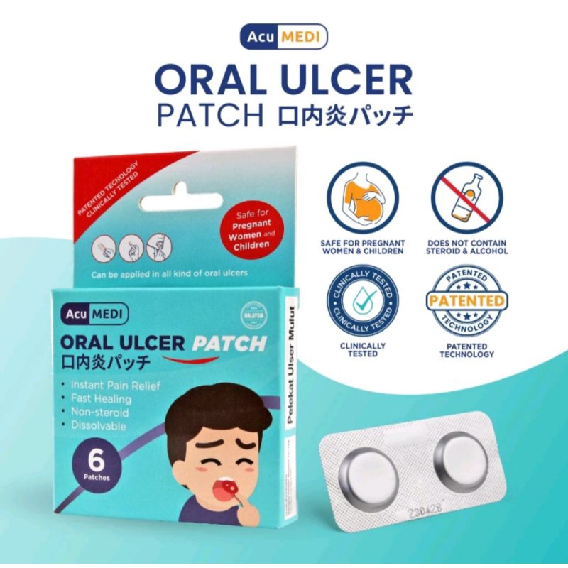 ORAL ULCER PATCH VIRAL ACU-MEDI | Shopee Malaysia