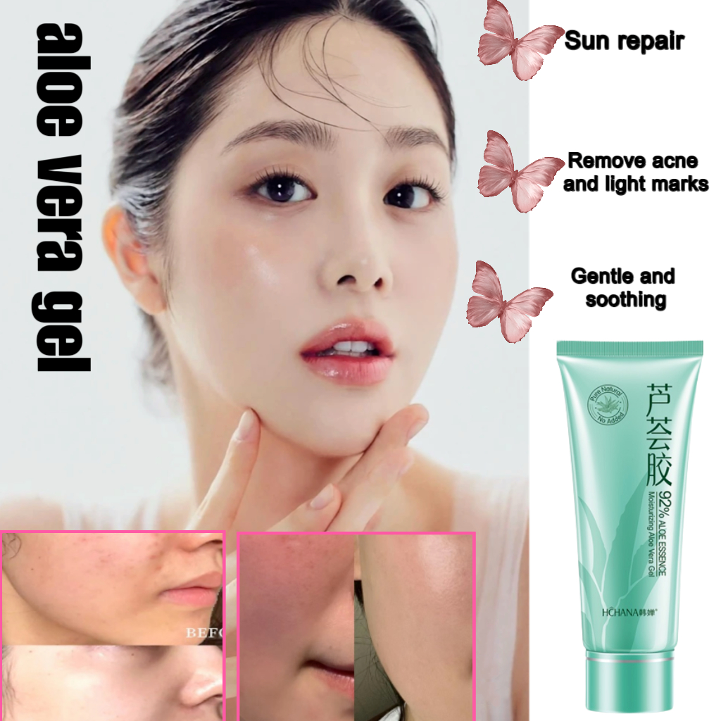 Hydrating Aloe Vera Gel Anti-Acne Treatment 100% Original Aloe Vera Gel ...