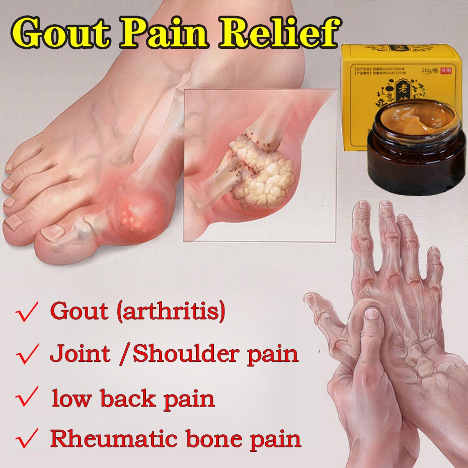 Ubat gout-Jamu asam urat-Gout ointment 30g Specializing in joint pain ...