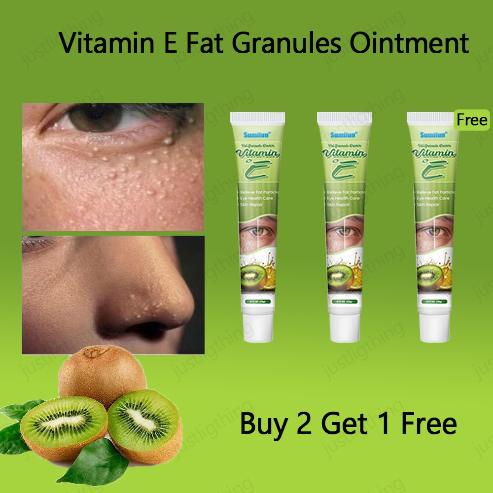 vitamin E eye cream Remove Fat granule Flat warts Grease grains Sweat ...