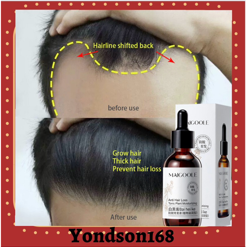 💯Tonik rambut 生发液 Original Hair Tonic Hair Growth Serum Ubat Rambut ...