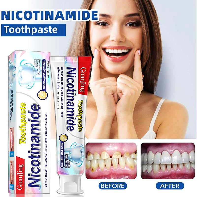nicotinamide toothpaste teeth whitening toothpaste Niacinamide ...