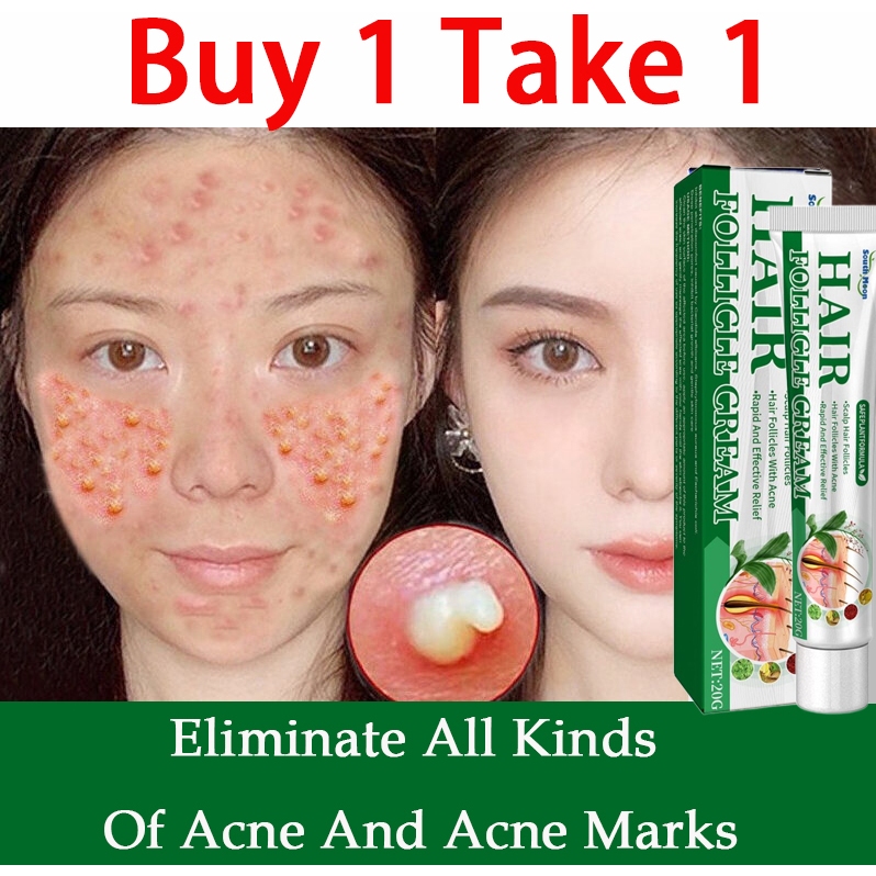 Acne Pimple Salicylic Acid Pimple Warrior Salicylic Acid Acne Spot ...