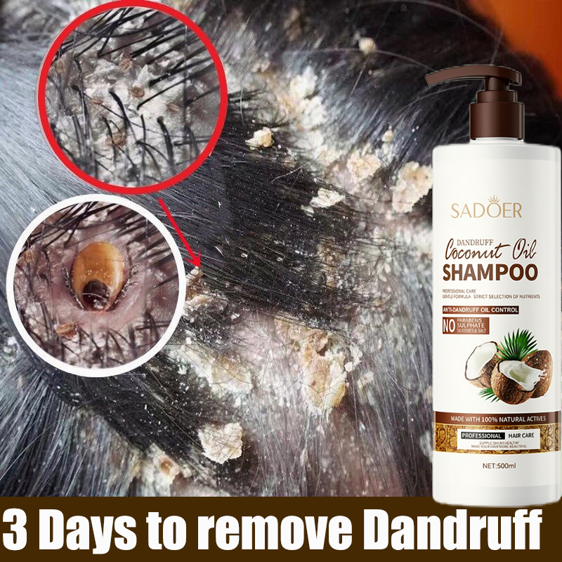 Coconut Shampoo Shampoo Kelemumur Shampoo Dandruff Coconut Oil Dandruff Removal Shampoo Oil ...