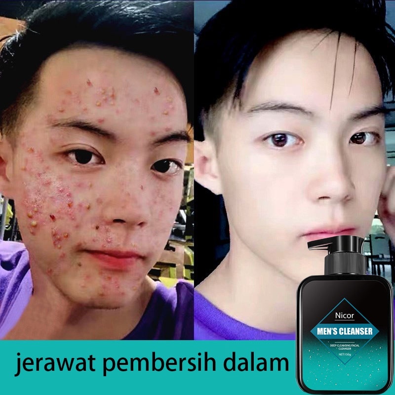 facial cleanser pencuci muka lelaki sabun muka jerawat mites acne Oil ...
