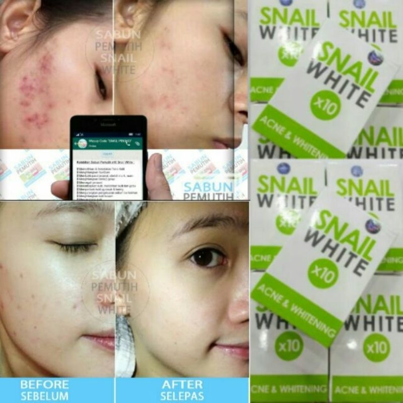 Sabun Jerawat Snail Whitening 10 Ganda/ Acne Snail Soap/ Ori Thai ...