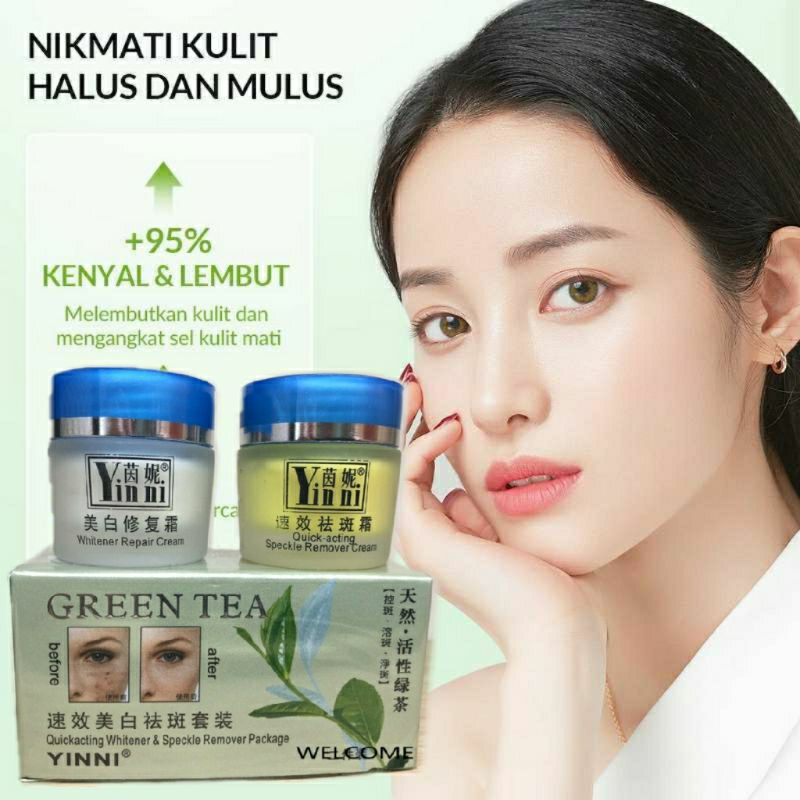 (18g x2) Green tea Day & Night Pigment Freckle Dark Spot Melasma Whitening Cream / Krim Hapus ...