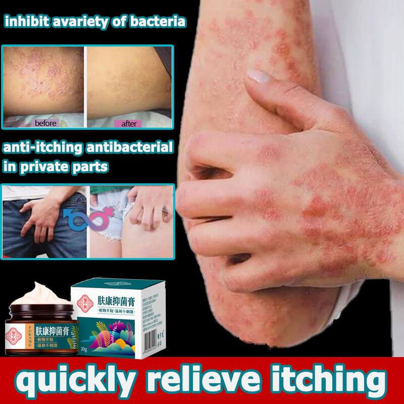 Ubat Gatal Kemaluan cream gatal kulit Psoriasis Antifungal Cream ...