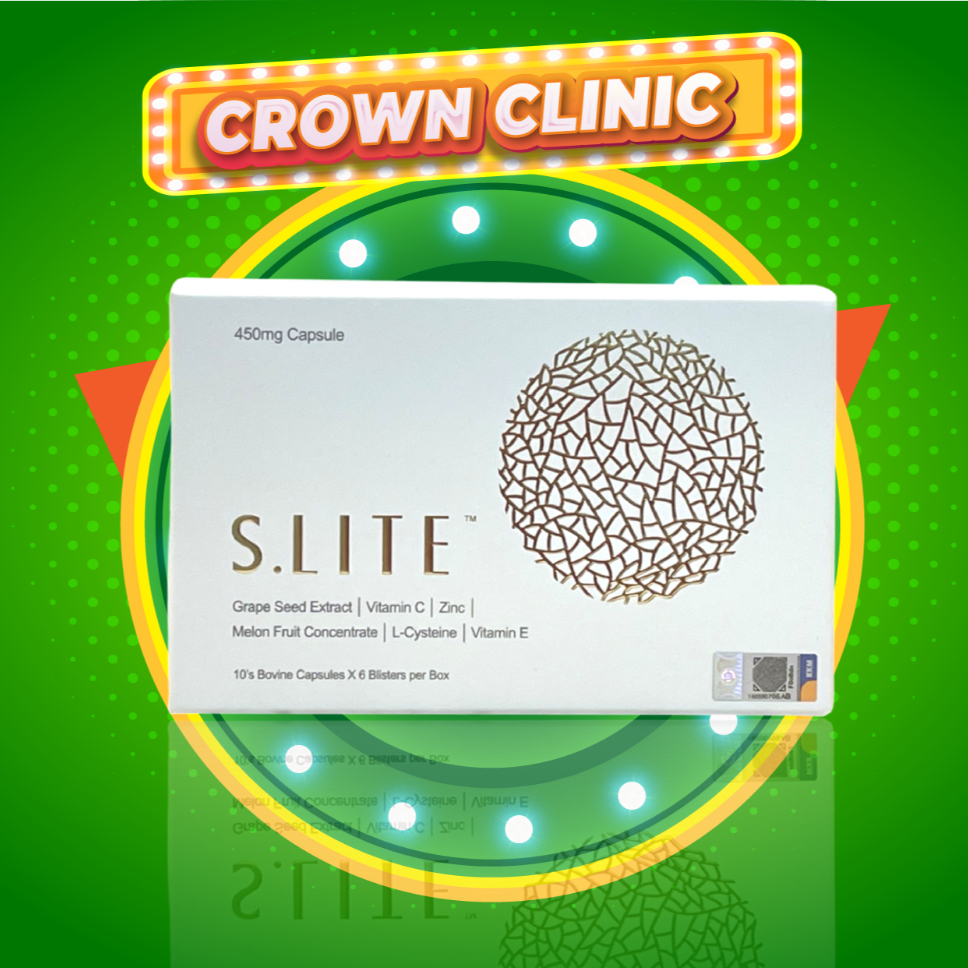 S.LITE ™ (60 capsules) 450MG (Clearance) | Shopee Malaysia