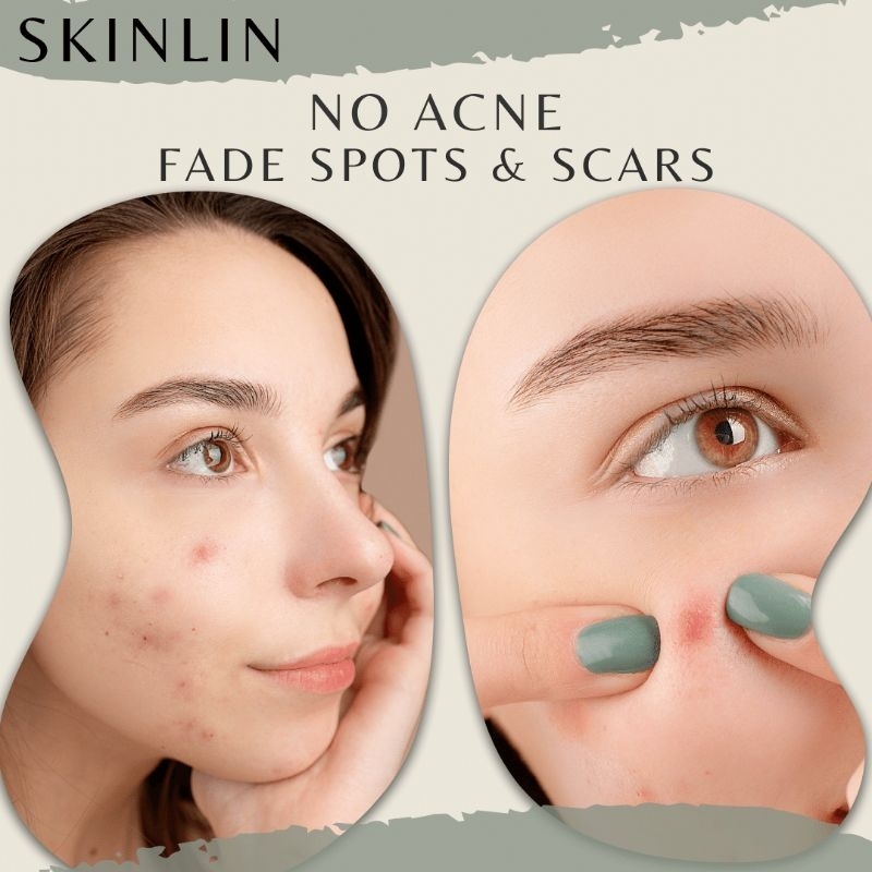 SKINLIN No Acne - Fade Spots & Scars | Quick Repair Formula | Even Skin ...