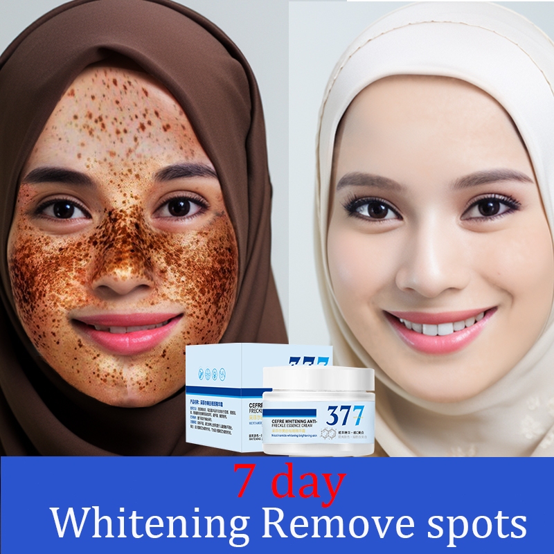 377 Whitening Freckle Remover Cream Krim jeragat Dark Spot Brightens ...
