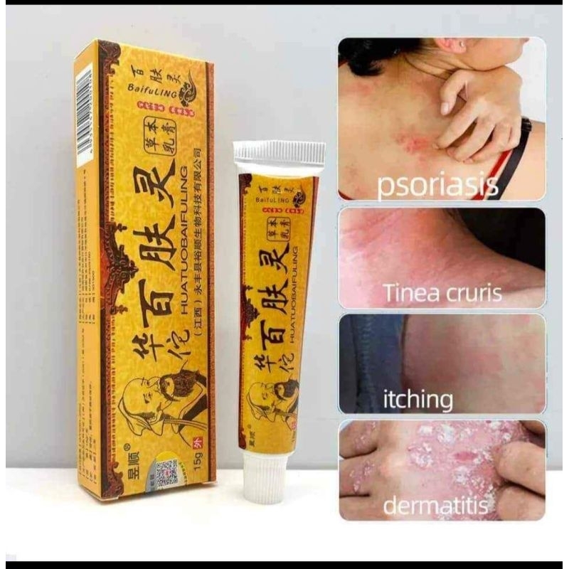 Ringworm/Eczema /Gatal/PsoriasisAntibacterial Anti-fungal cream ...
