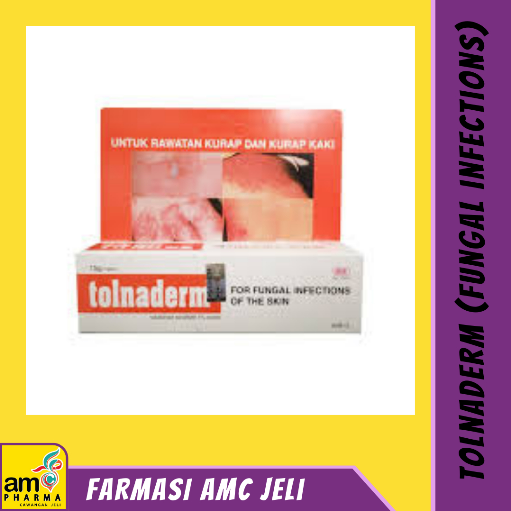 HOE TOLNADERM CREAM (RAWATAN KURAP DAN KURAP KAKI,PANAU,RUAM,GATAL ...