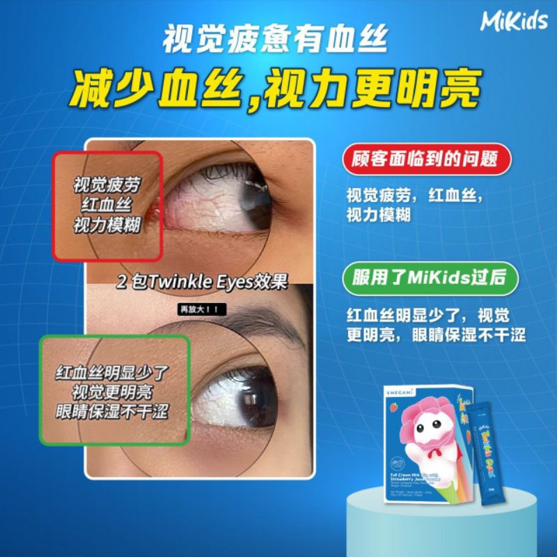 全家必备👀大马护眼代餐Xmegami Mikids Twinkle Eyez儿童孩子眼睛 守护眼睛 防蓝光电子产品提高学习专注力 懒惰眼 近视散光青光眼飞蚊症干眼症红眼症Eyes care ...