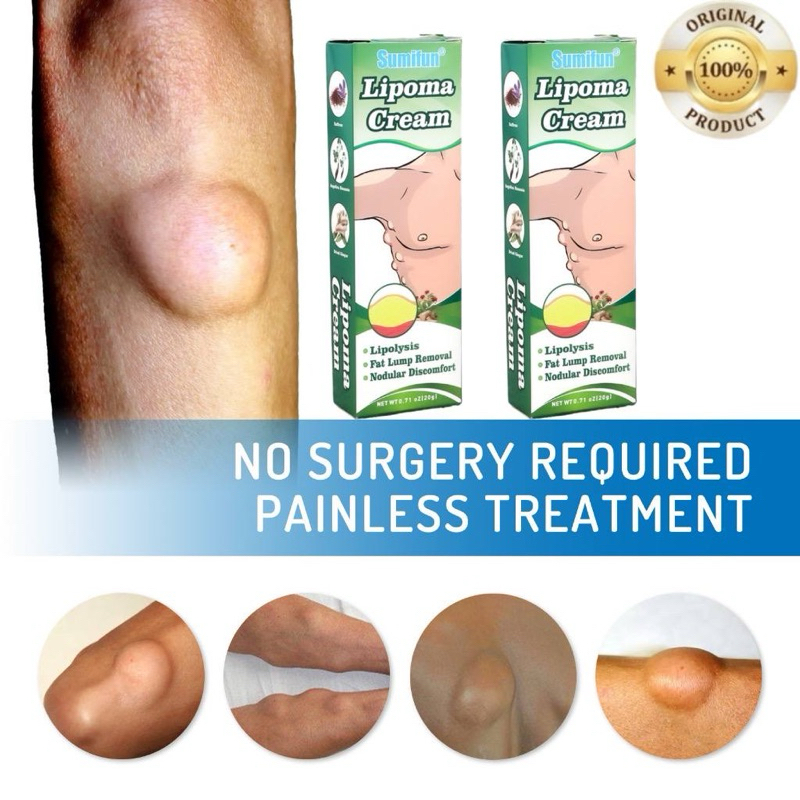 krim lipoma buang lemak ketiak leher belakang telinga buang toksin ...