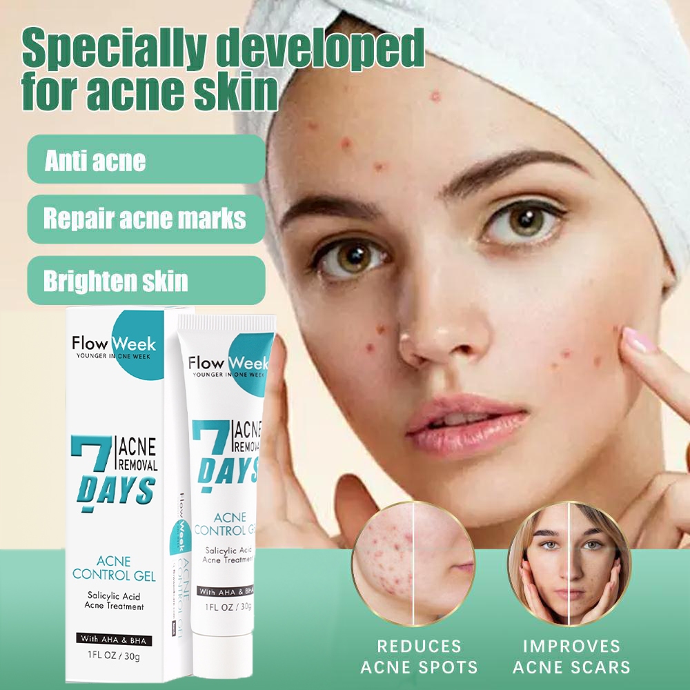 Anti Acne Salicylic Acid Acne Gel Treatment Pimple Eraser Spot Care ...