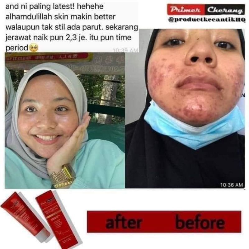 PrimEr Cherang Brightening Cream ( Treatment ) | Shopee Malaysia