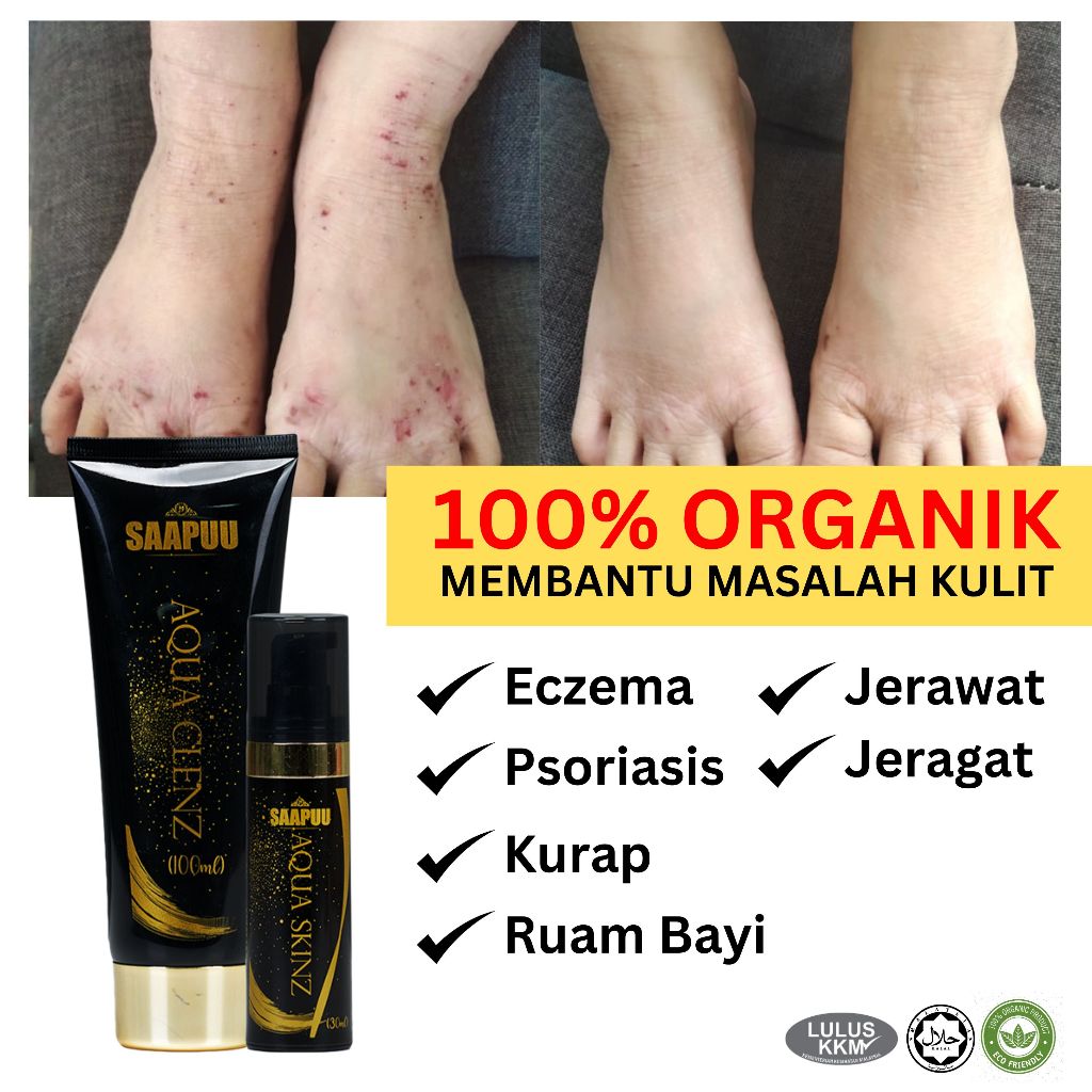 ORIGINAL [READY STOCK] SaaPuu Skin : Membantu masalah kulit sensitif ...