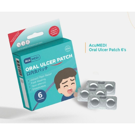 ACUMEDI ORAL ULCER PATCH PATCHES 6S EXP08/2026 | Shopee Malaysia