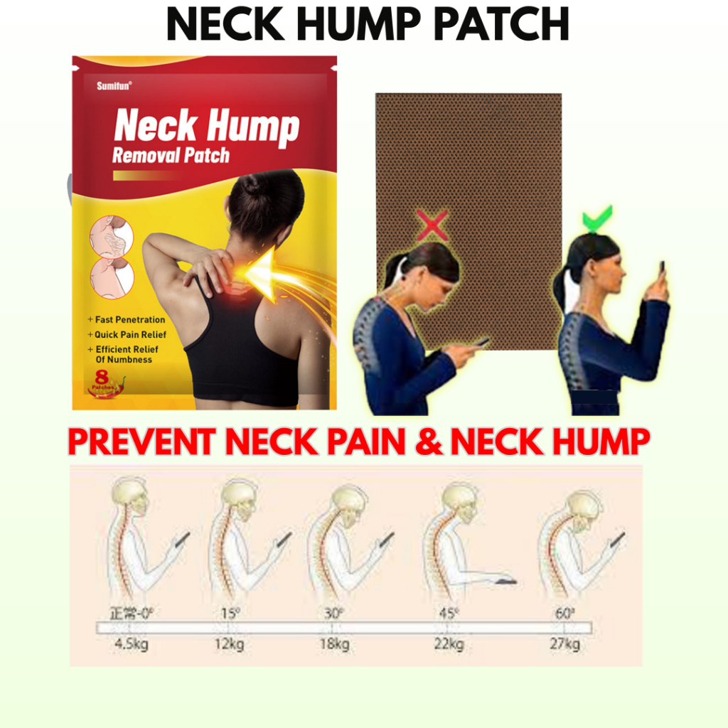 Neck Pain & Neck Hump Dowager Hump Buffalo Hump Relief Swollen Neck ...