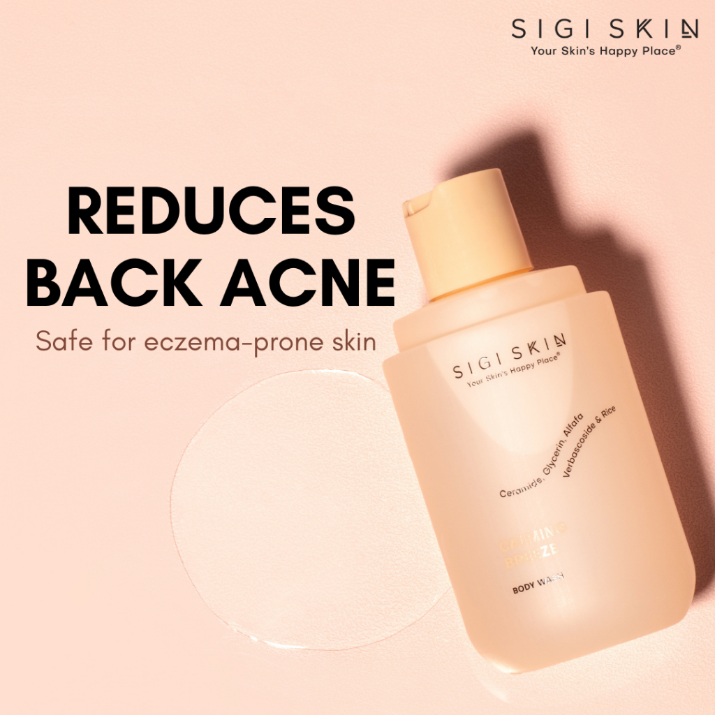 Sigi Skin Calming Breeze (326 mL) | Shopee Malaysia