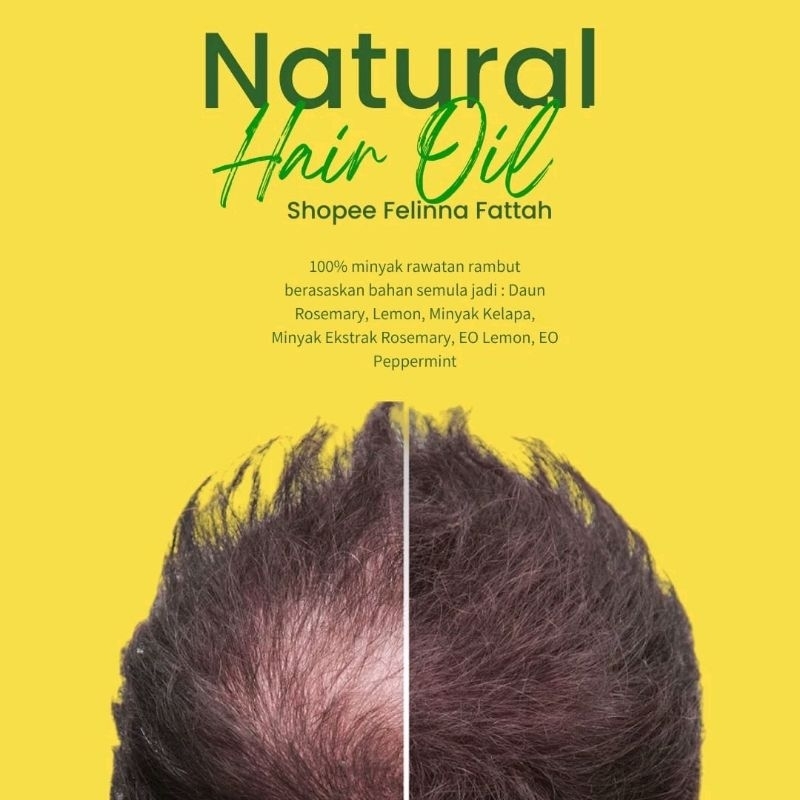 Natural | Minyak Rambut | Lebat Rambut | Kelemumur | Rambut Gugur ...