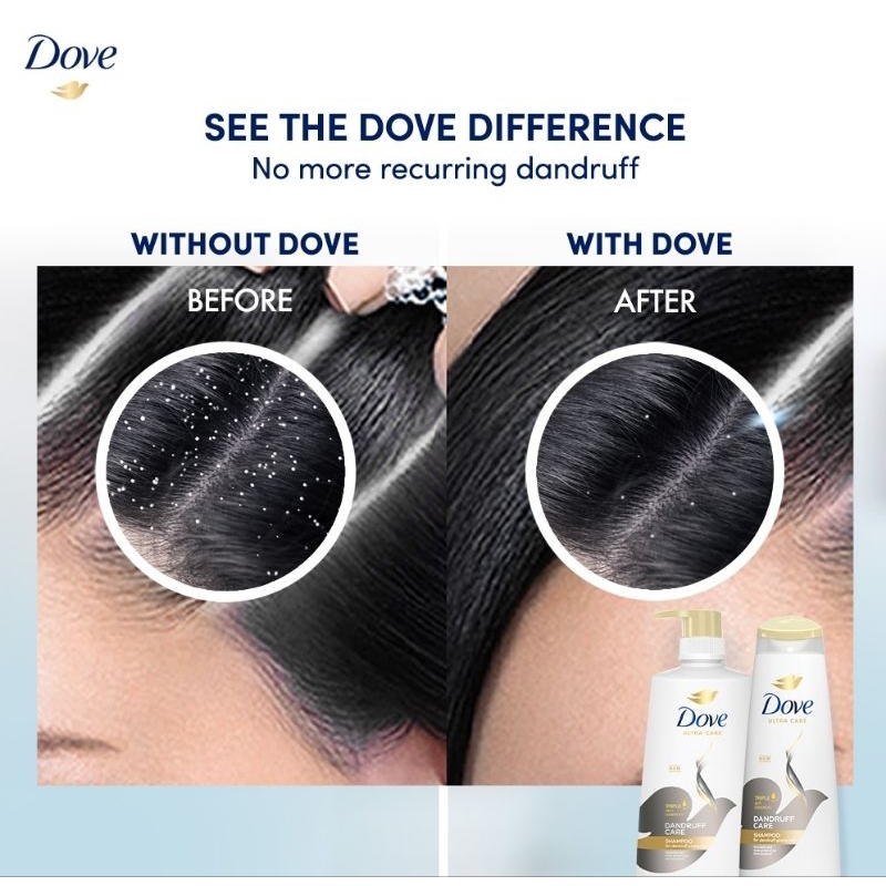 Dove Nutritive solution shampoo dandruff care(330 ml) | Shopee Malaysia