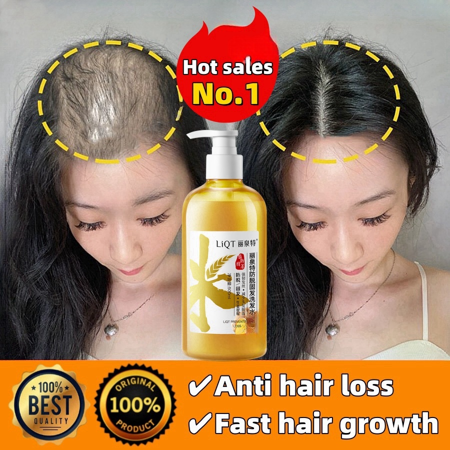 Hair loss shampoo-Hair growth shampoo-Ginger shampoo 500ML Anti hair ...