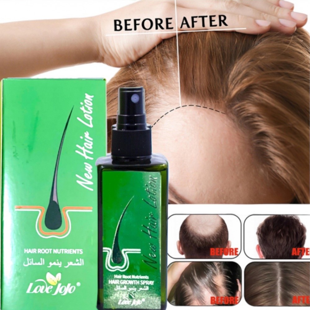 [ Limited Time Offer ] Hair Growth Love JoJo New Hair Lotion Hair Root ...