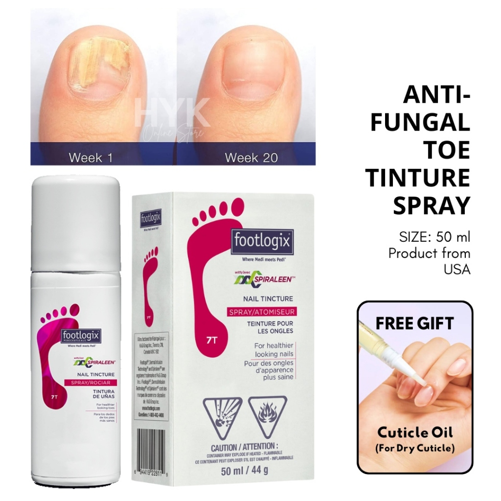 READY STOCK🇲🇾 Footlogix Nail Tincture Anti fungus spray Fungal kuku ...