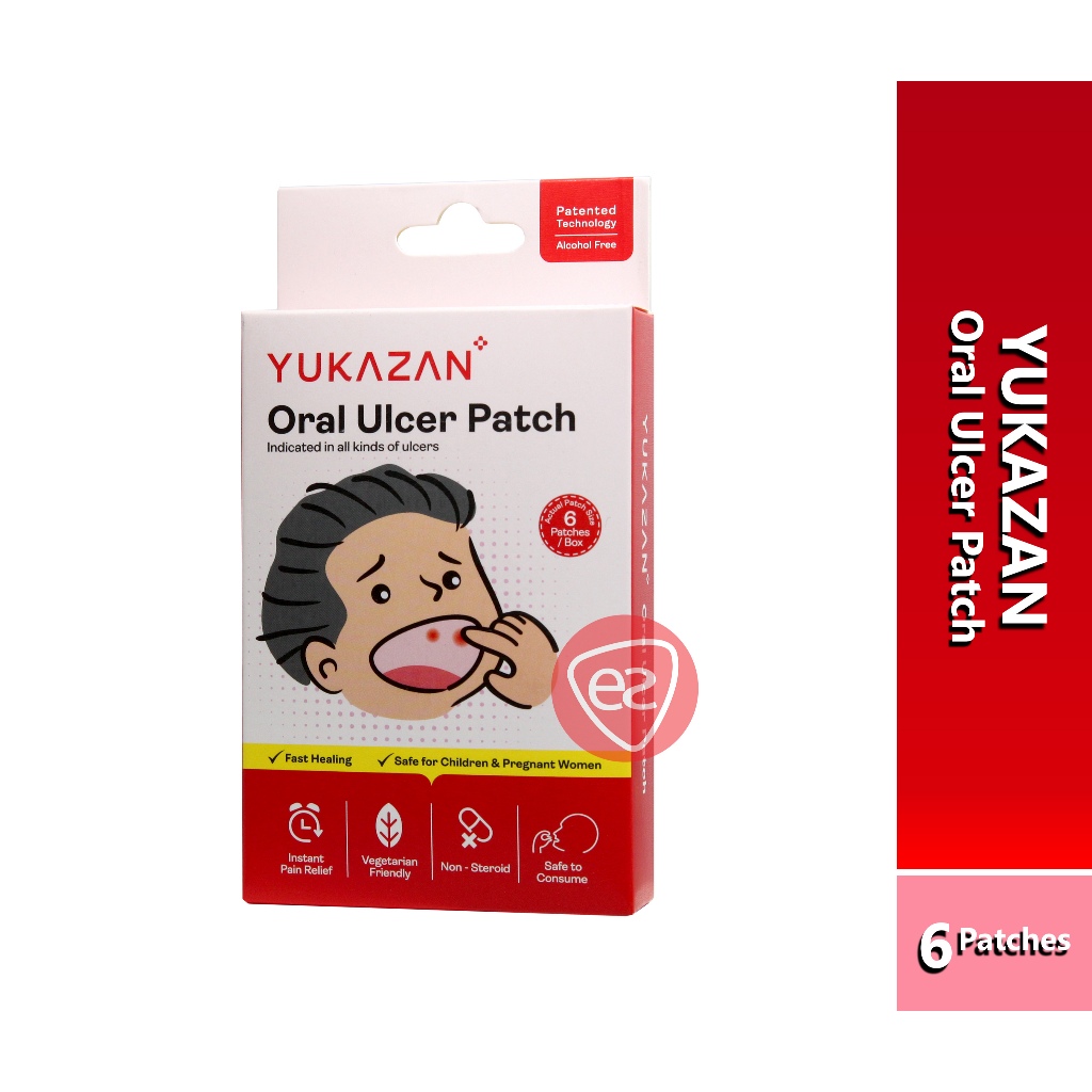 Yukazan Oral Ulcer Patch / Pelekat Ulser Mulut (6 pcs) For Instant Pain ...