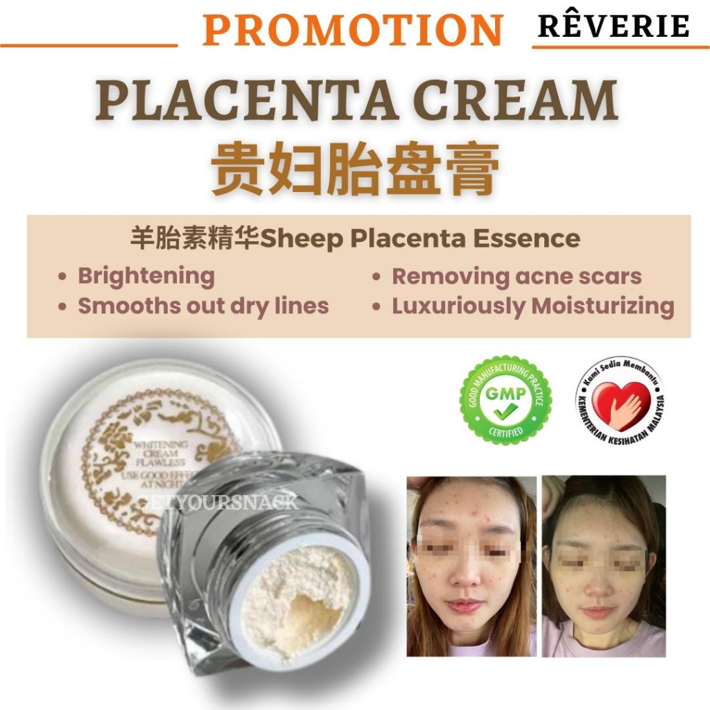 【Free gift】Reverie Sheep Placenta Cream 胎盘膏30g Miracle Moisturizing ...