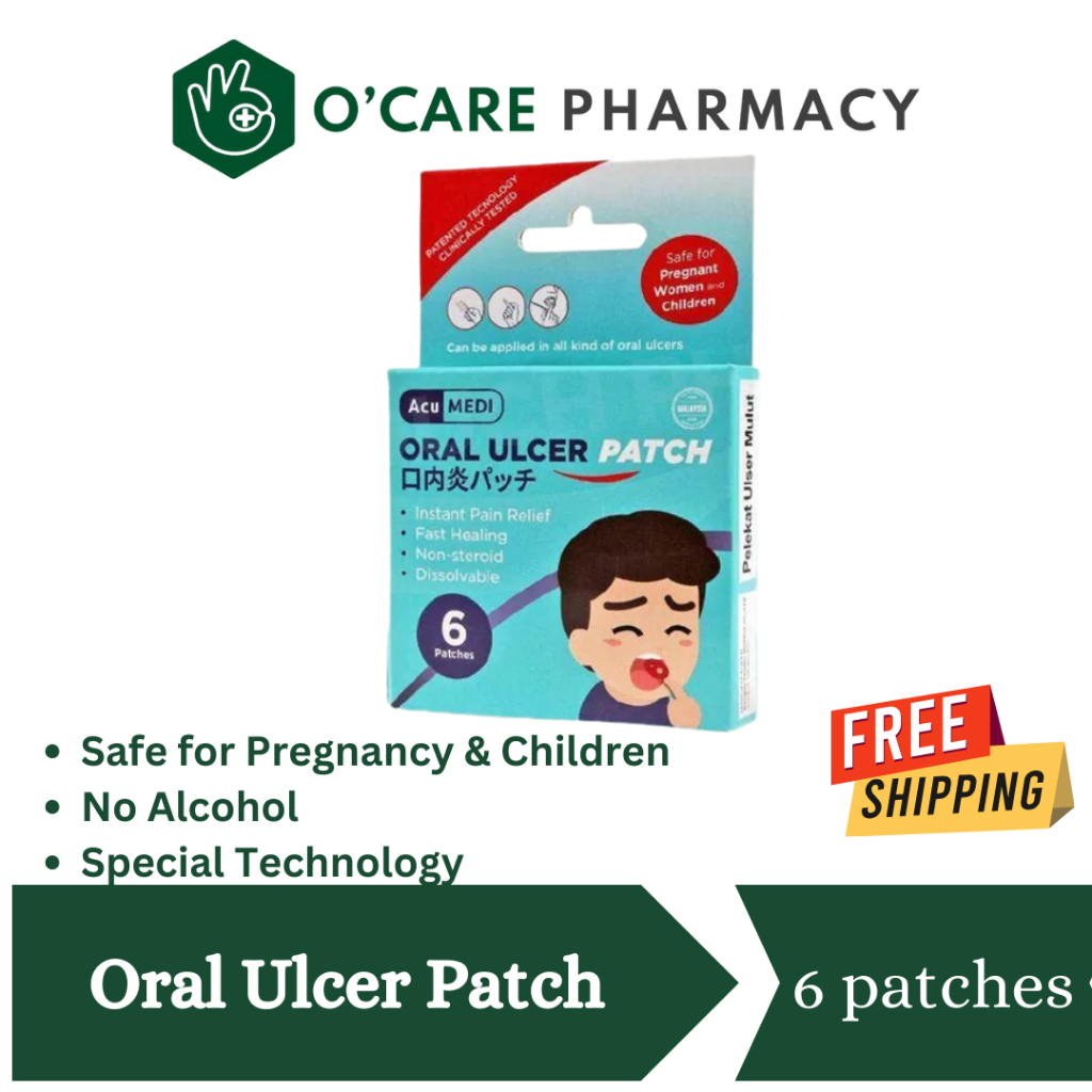 Oral Ulcer Patch AcuMEDI Pelekat Ulcer for Children and Adult Viral ...