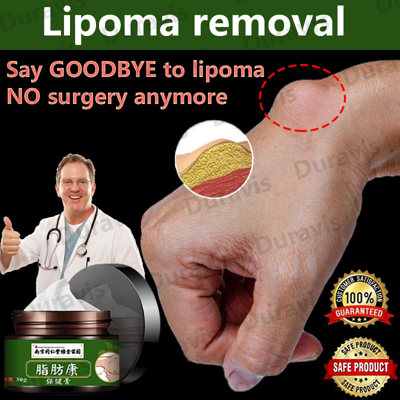 lipoma cream - lipoma removal cream - lipoma 脂肪康 30g quickly and ...