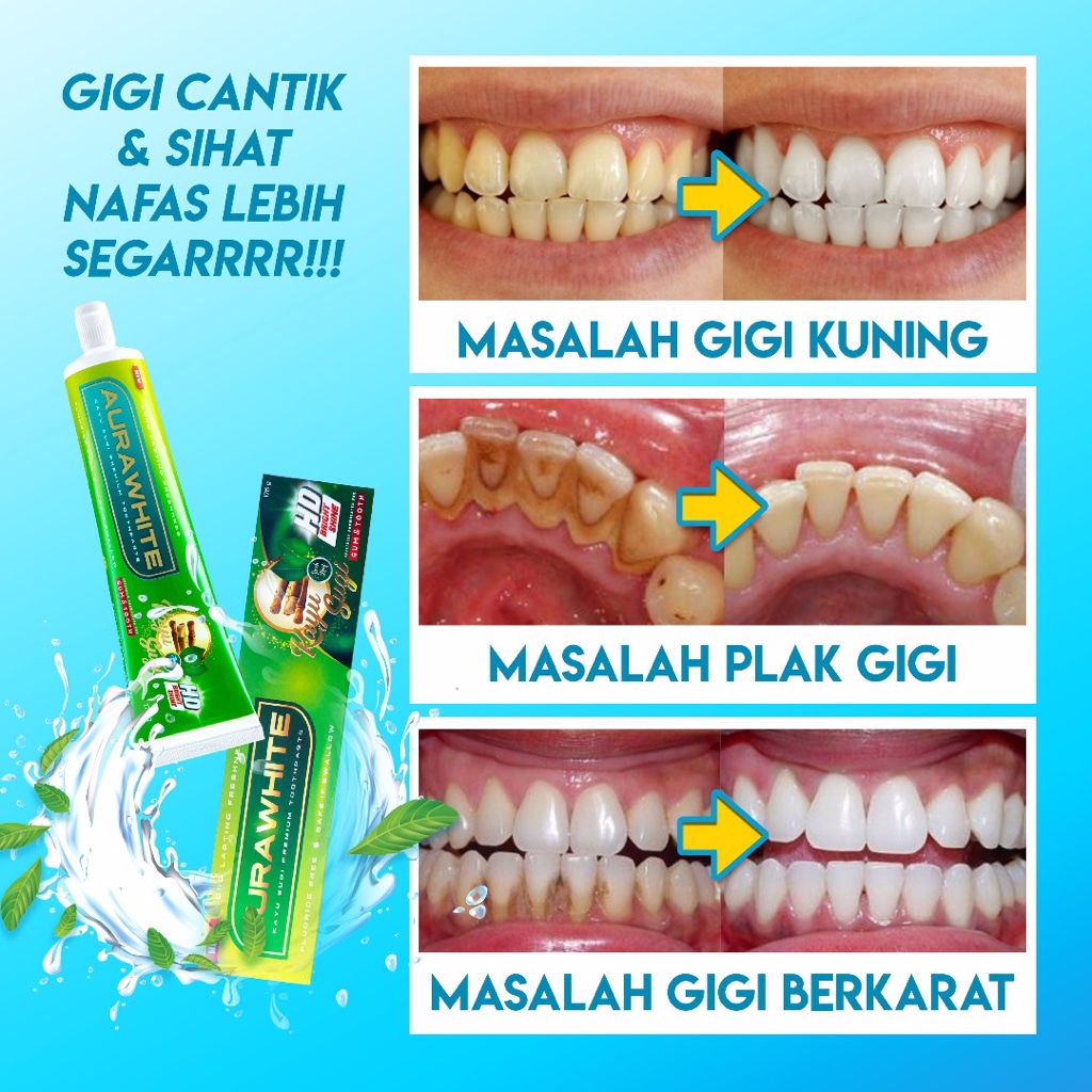 [READY STOCK] Ubat Gigi Kayu Sugi Premium Putihkan Gigi 100% Halal ...